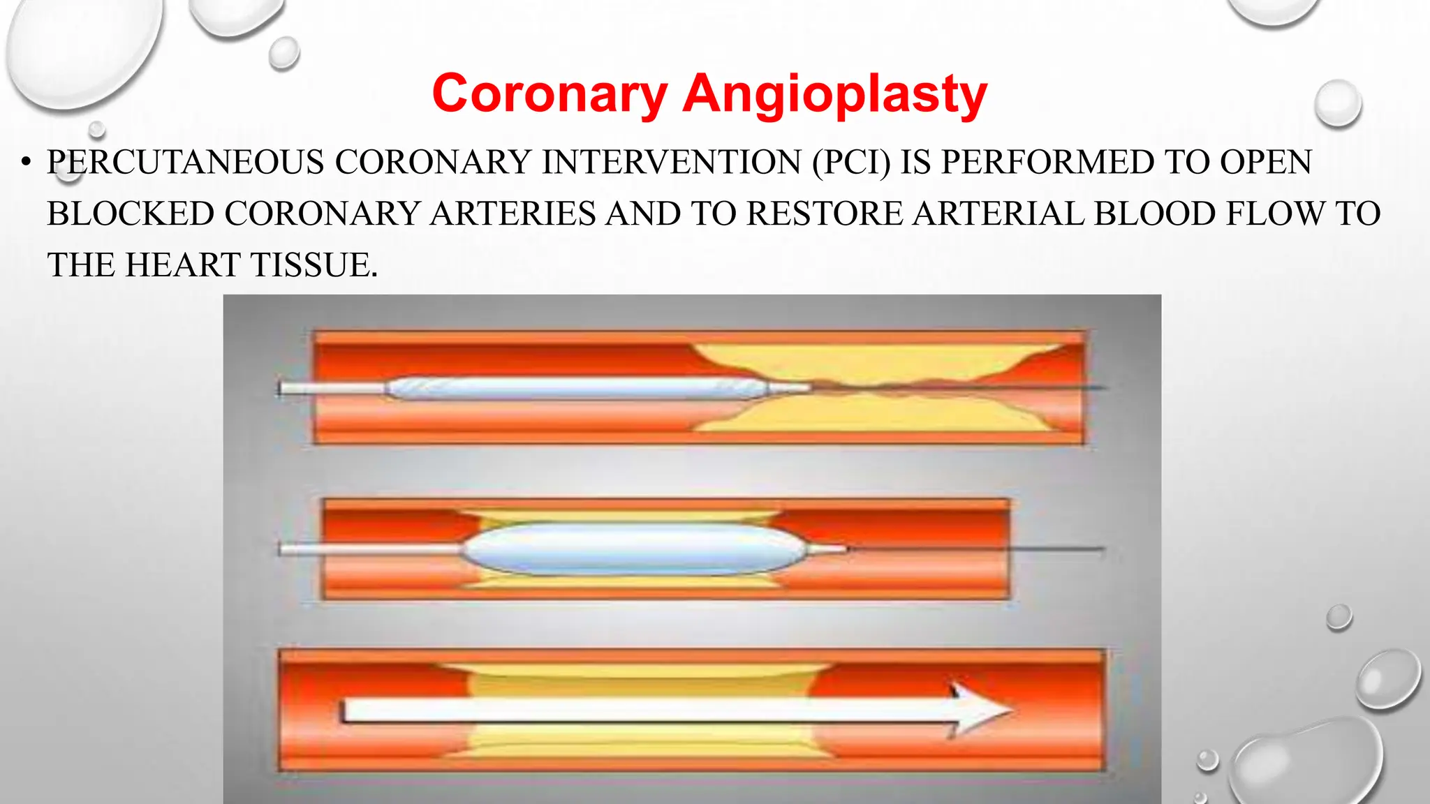 close heart surgery and open heart surgery | PPTX