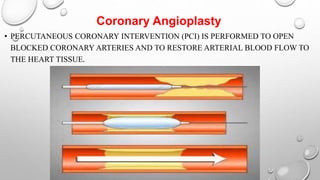 close heart surgery and open heart surgery | PPTX