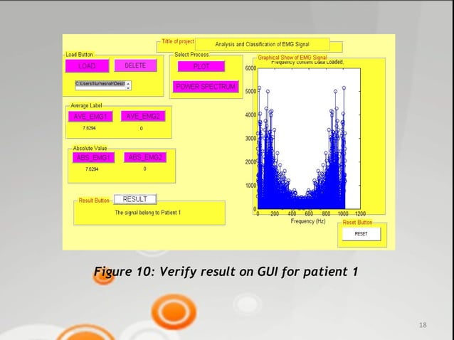PRESENTATION LAB DSP.Analysis & classification of EMG signal - DSP LAB | PPT