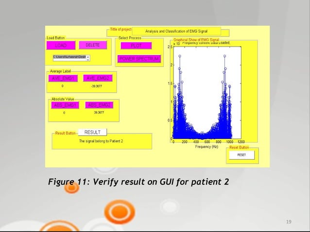 PRESENTATION LAB DSP.Analysis & classification of EMG signal - DSP LAB | PPT