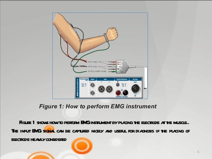 Techniques Of Emg Signal Analysis Detection Processing Classification