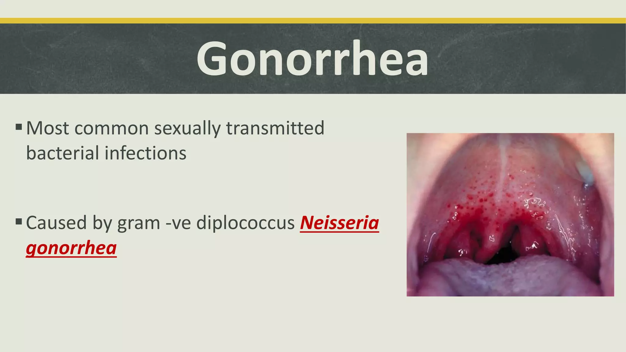 Bacterial Infections of Oral Cavity | PPTX