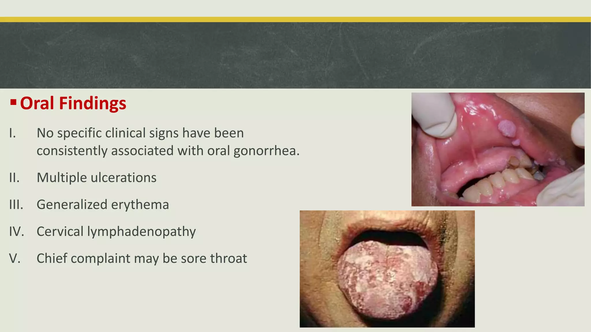 Bacterial Infections Of Oral Cavity Pptx
