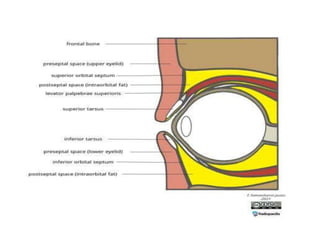 Preseptal and orbital cellulitis MD5 by Noel | PPTX