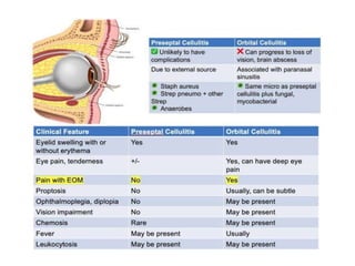 Preseptal Cellulitis Vs Orbital Cellulitis