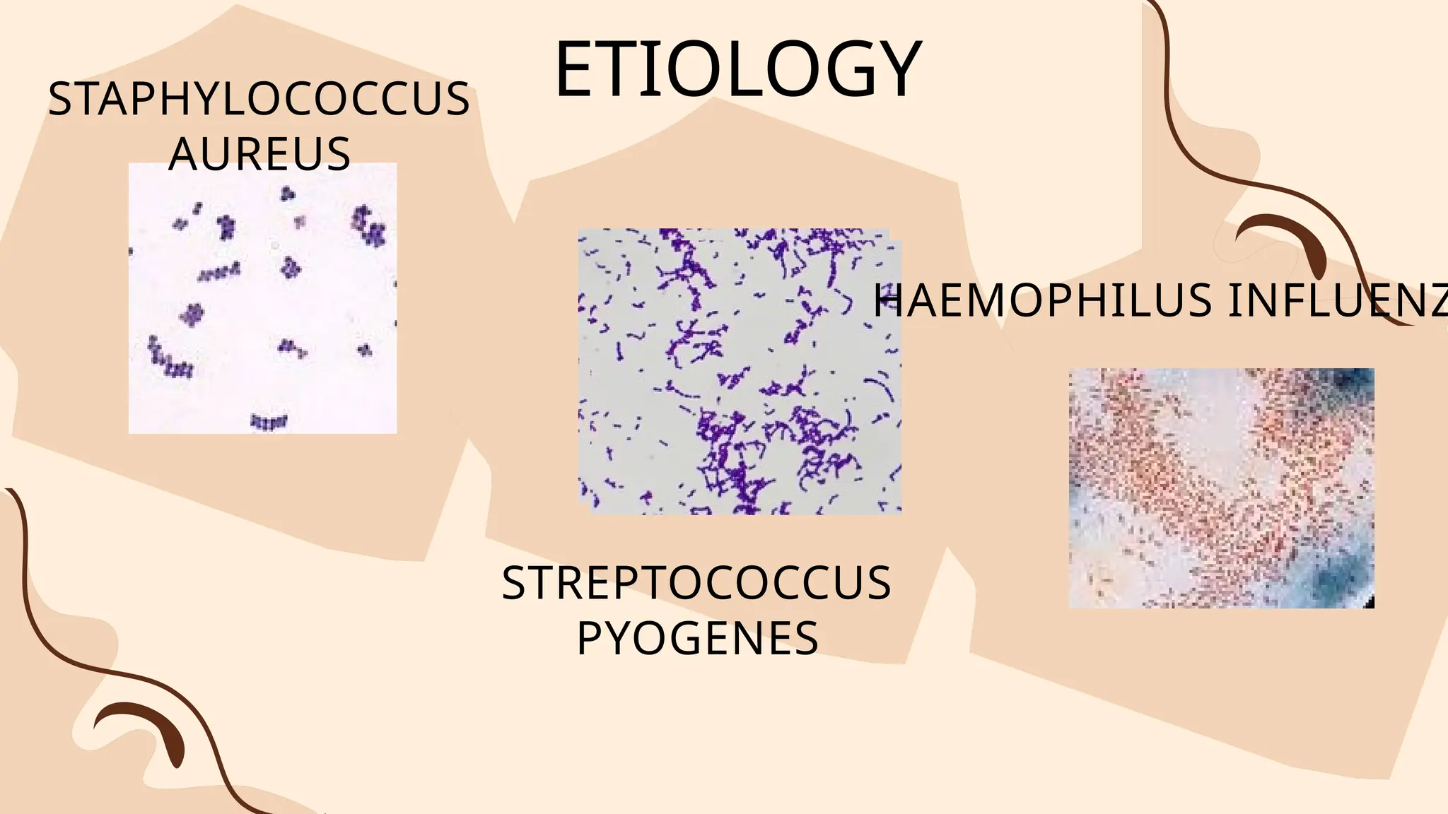 PRESEPTAL CELLULITIS ophthalmology mbbs | PPTX