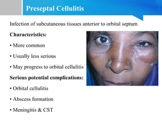 Comprehensive Management of Preseptal and Orbital Cellulitis, OAS, and ...