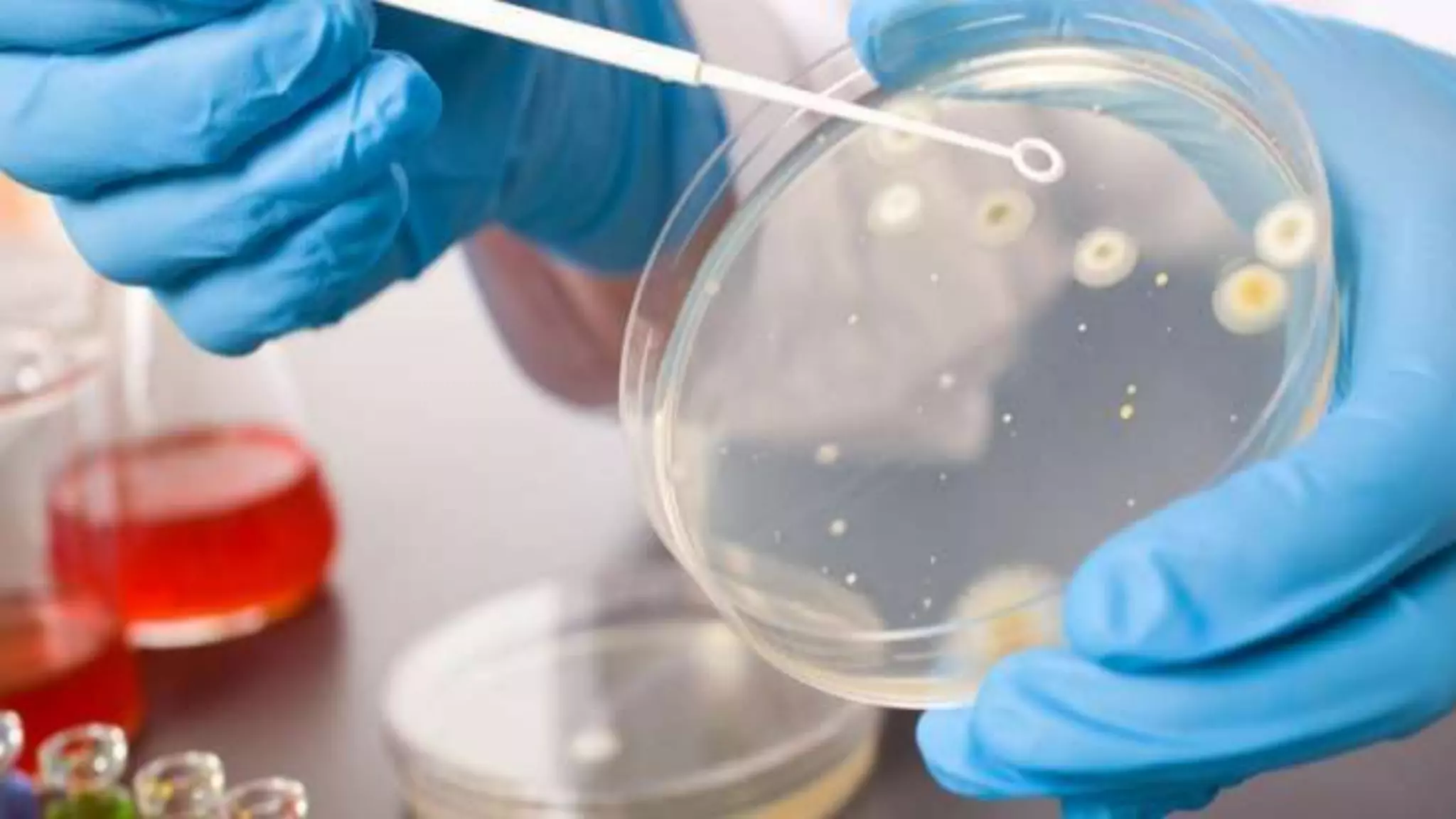 Preservation of bacteria for short term | PPTX