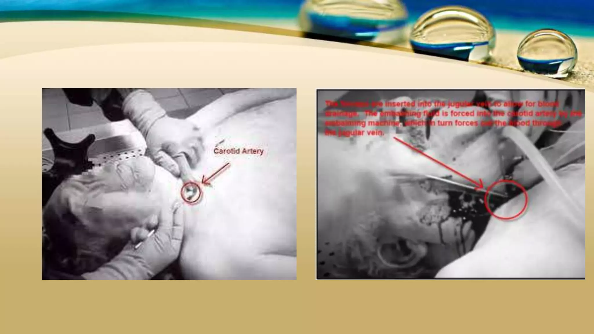 Preservation of dead body | PPTX