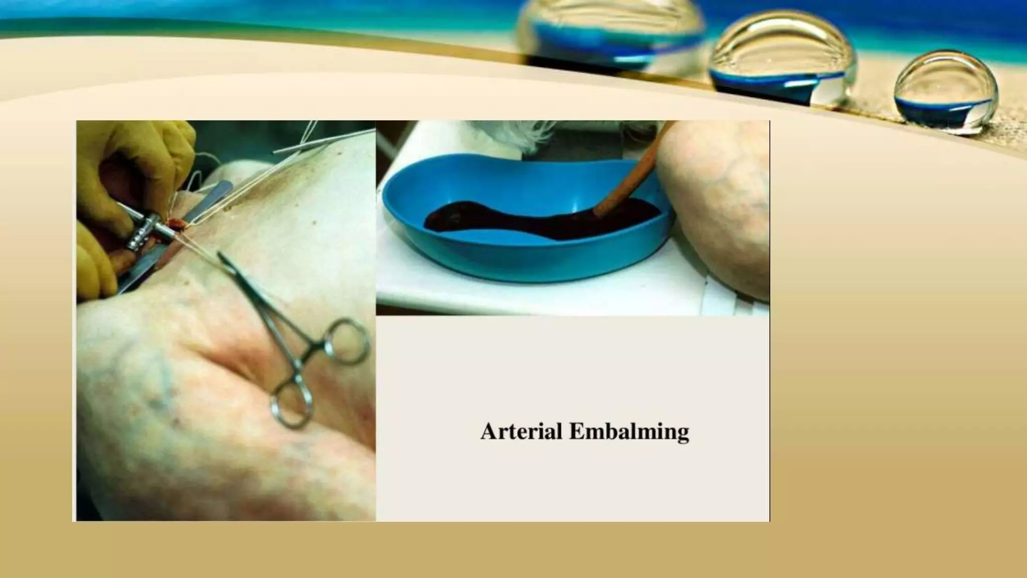 Preservation of dead body | PPTX