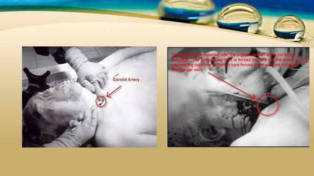 Preservation of dead body | PPTX | Infectious Diseases | Diseases and ...