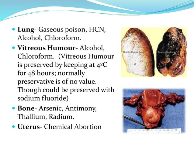 Preservation of viscera | PPTX | Chemistry | Science