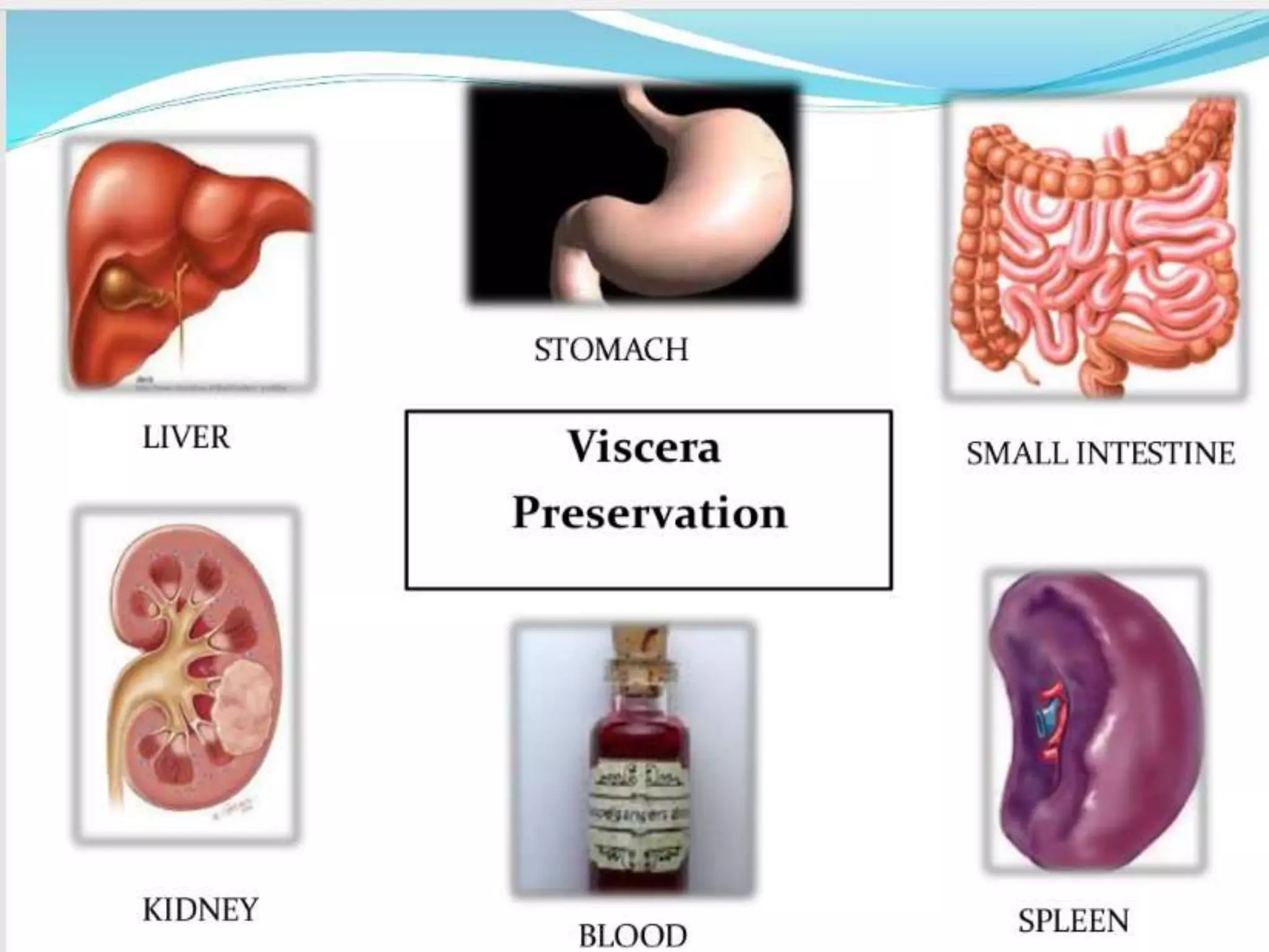 PRESERVATION OF VISCERAS.pptx