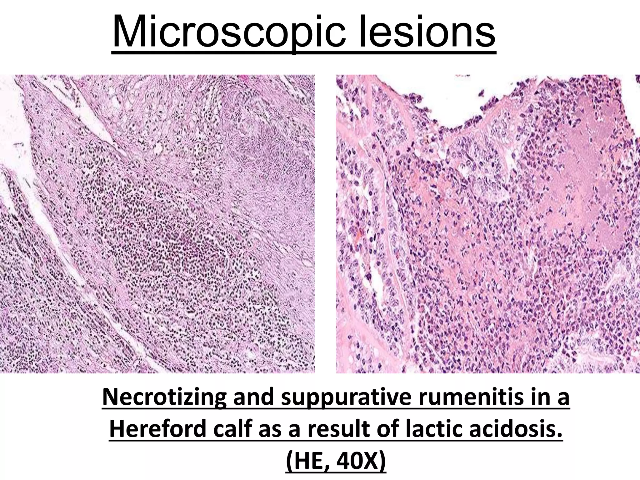 Presetation on rumen impaction lactic acidosis final osr | PPTX