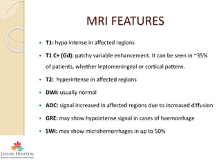 MRI SPECTRUM OF POSTERIOR REVERSIBLE ENCEPHALOPATHY SYNDROME | PPTX
