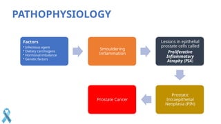 Prostate cancer is the most common in men. | PPTX