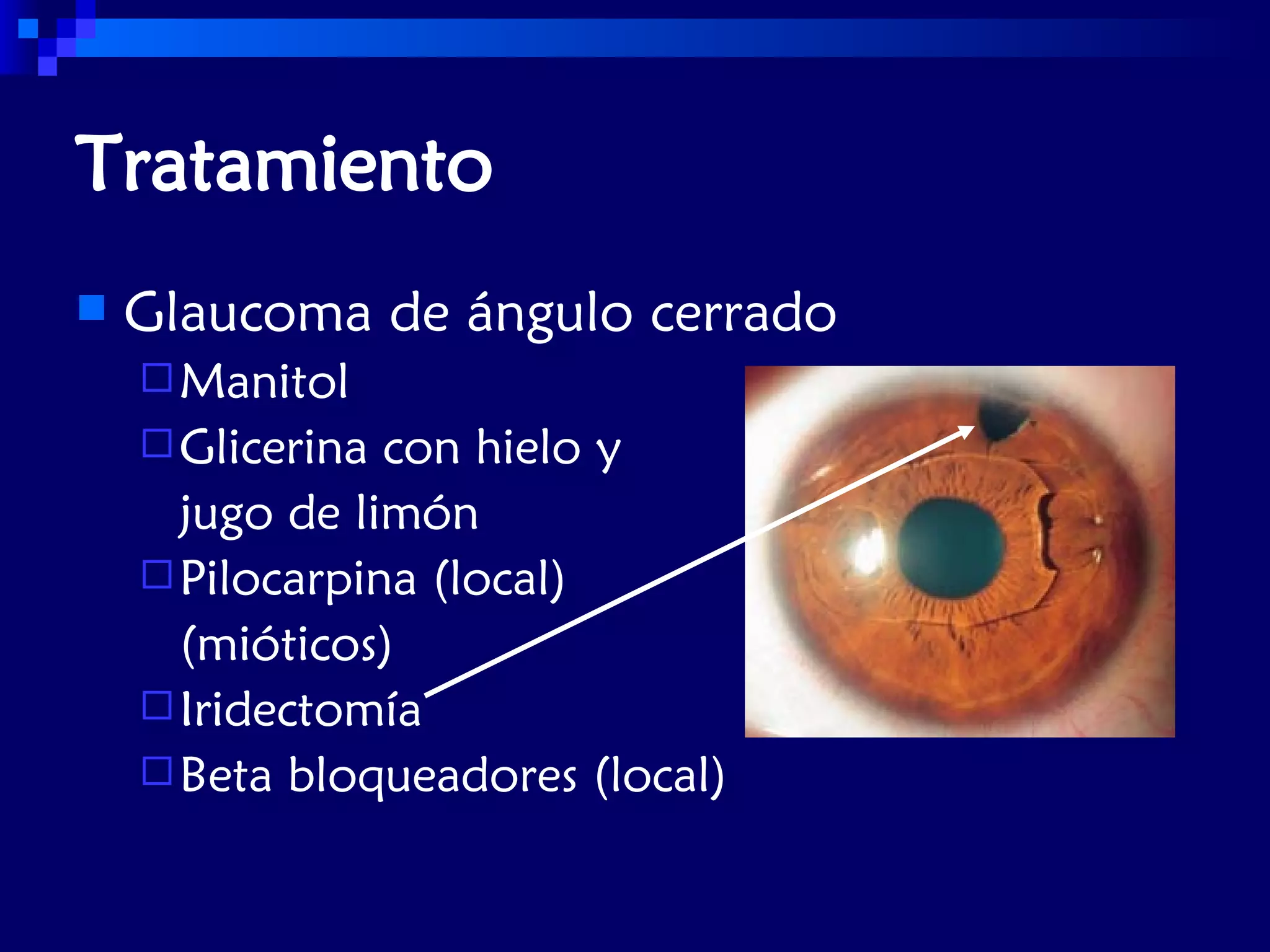 Presión Intraocular y Glaucoma | PPT