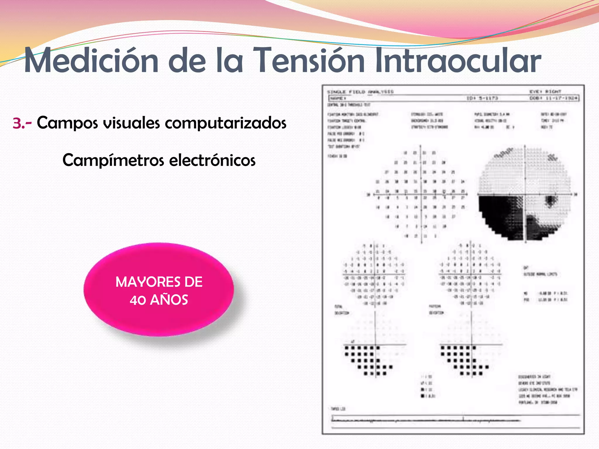 Presión intraocular y glaucoma | PPTX