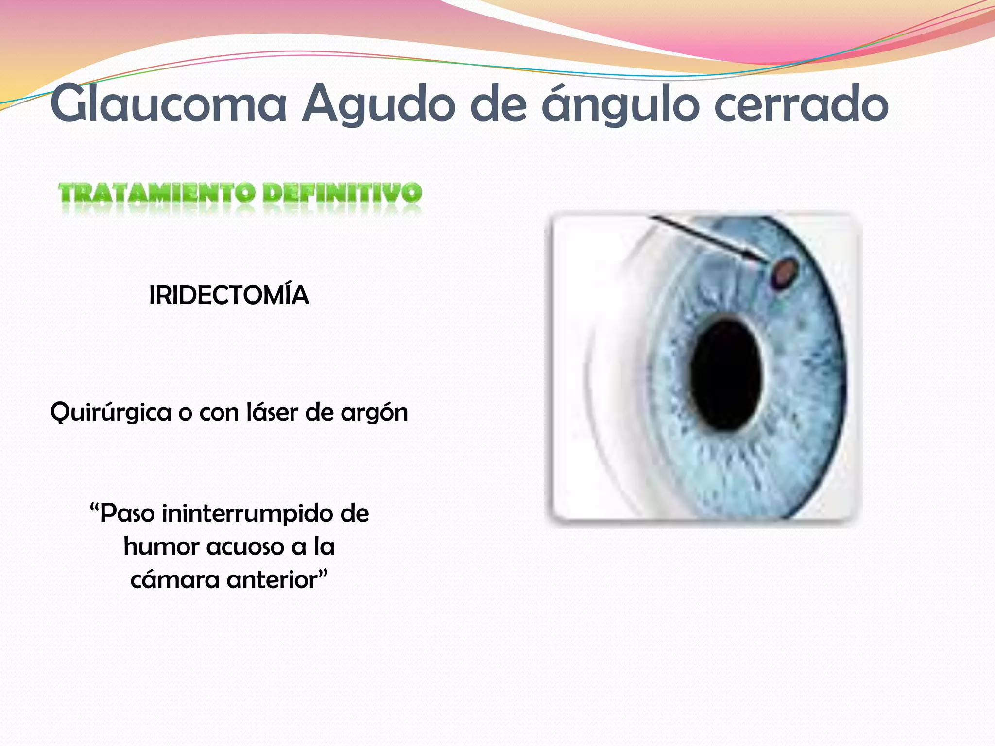 Presión intraocular y glaucoma | PPTX