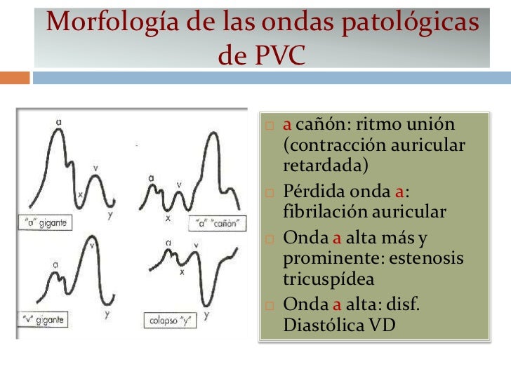 PresióN Venosa Central