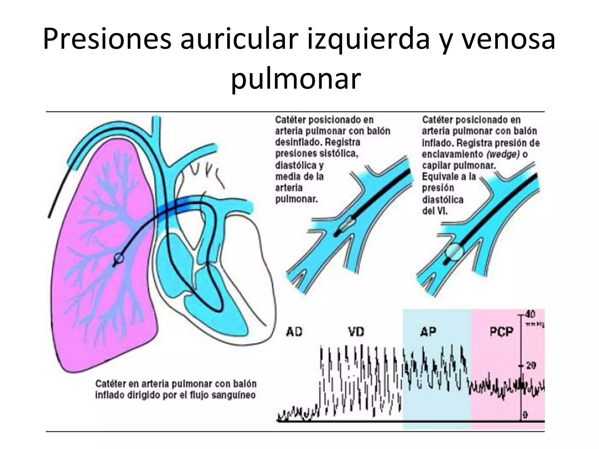 Presiones en el sistema pulmonar | PPT