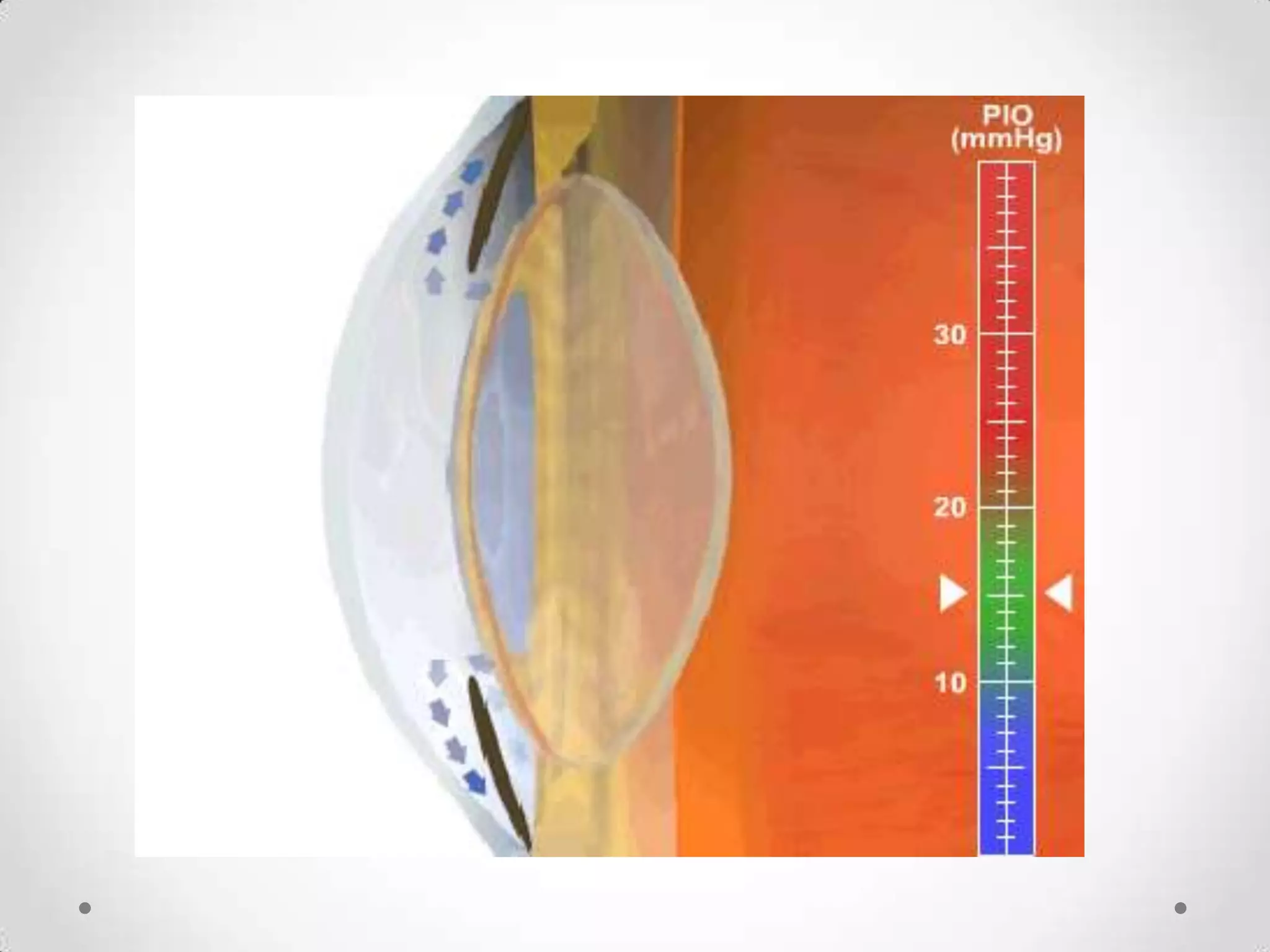 Presion intraocular | PPTX