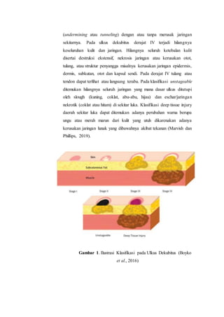 Preskas ulkus dekubitus wagner 3 | DOCX