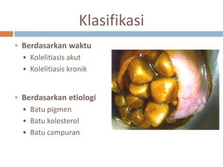 Preskas Cholelitiasis.ppt