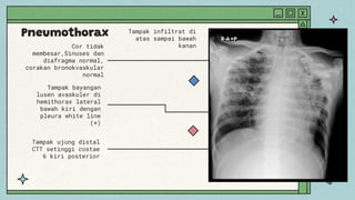 PRESKAS DANISA RADIOLOGI.pptx