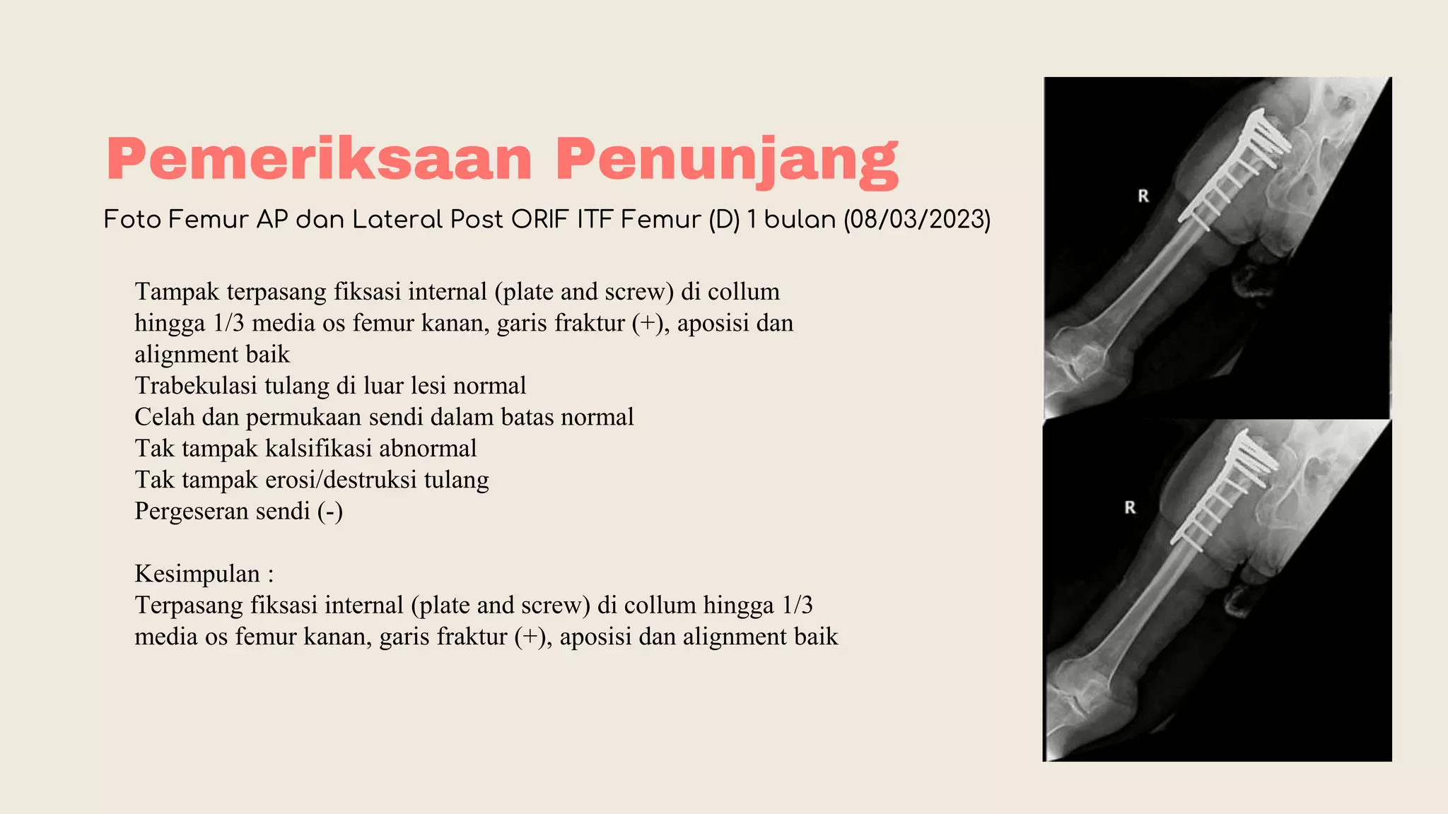 Preskas Kelompok dr. Rhyan, Sp. OT.pptx