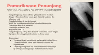 Preskas Kelompok dr. Rhyan, Sp. OT.pptx