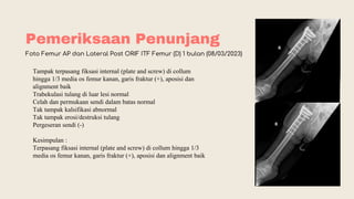 Preskas Kelompok dr. Rhyan, Sp. OT.pptx