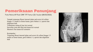 Preskas Kelompok dr. Rhyan, Sp. OT.pptx