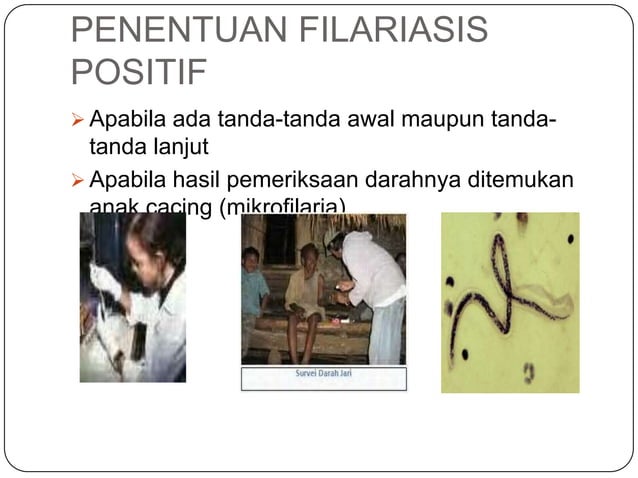 Presntasi filaria | PPTX