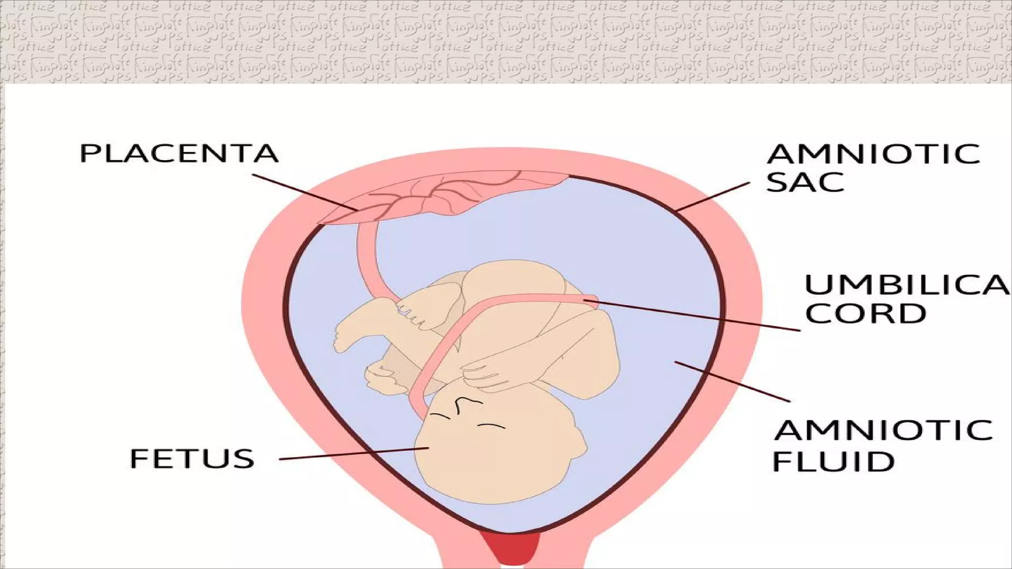 POLYHYDRAMNIOS | PDF