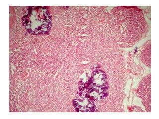 Práctica 2 AMI II | PPT