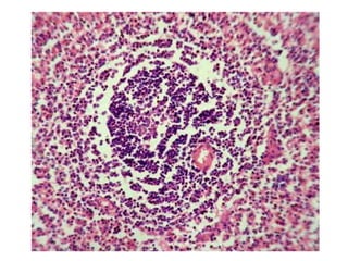 Práctica 2 AMI II | PPT