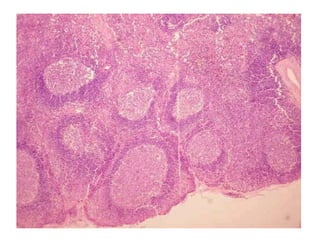 Práctica 2 AMI II | PPT