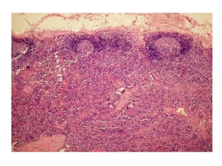 Práctica 2 AMI II | PPT