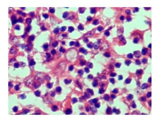 Práctica 2 AMI II | PPT