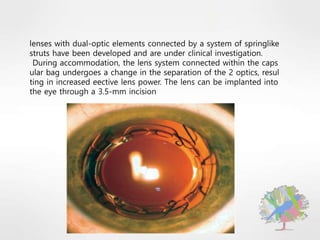 Presbyopia ( Part 1 / lenticular approach )..Types of MFIOL | PPTX ...