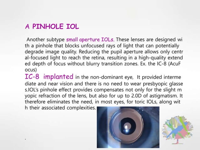 Presbyopia ( Part 1 / lenticular approach )..Types of MFIOL | PPT