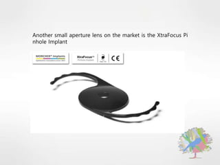 Presbyopia ( Part 1 / lenticular approach )..Types of MFIOL | PPTX ...