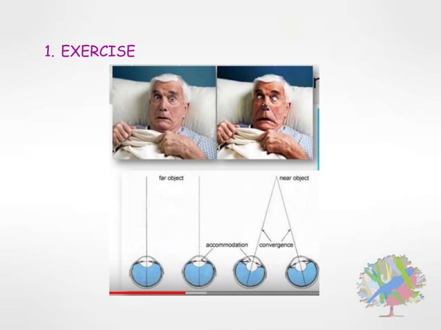 Presbyopia ( Part 1 / lenticular approach )..Types of MFIOL | PPT