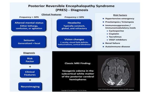 POSTERIOR REVERSIBLE ENCEPHALOPATHY SYNDROME | PPTX | Brain and Nervous ...