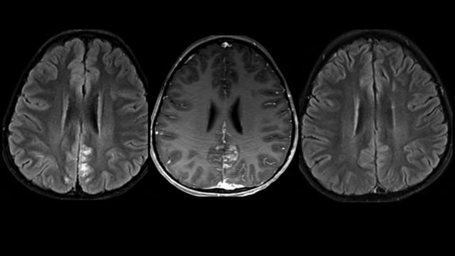 PRESS RADIOLOGY.pptx