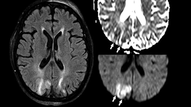 PRESS RADIOLOGY.pptx