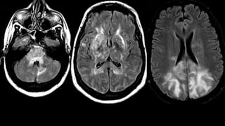 PRESS RADIOLOGY.pptx