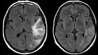 PRESS RADIOLOGY.pptx