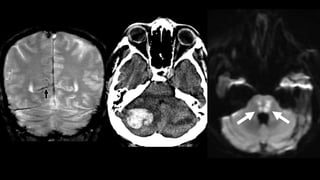 PRESS RADIOLOGY.pptx